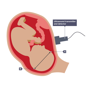 What are echoes and sonar? - BBC Bitesize