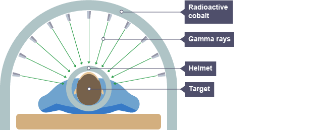 What Are Gamma Rays Used For Gamma Irradiation Sterilization Process