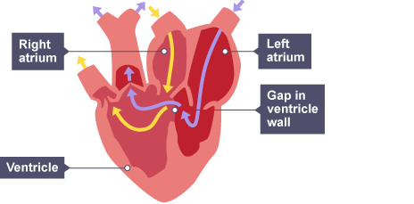 Bird Heart Diagram